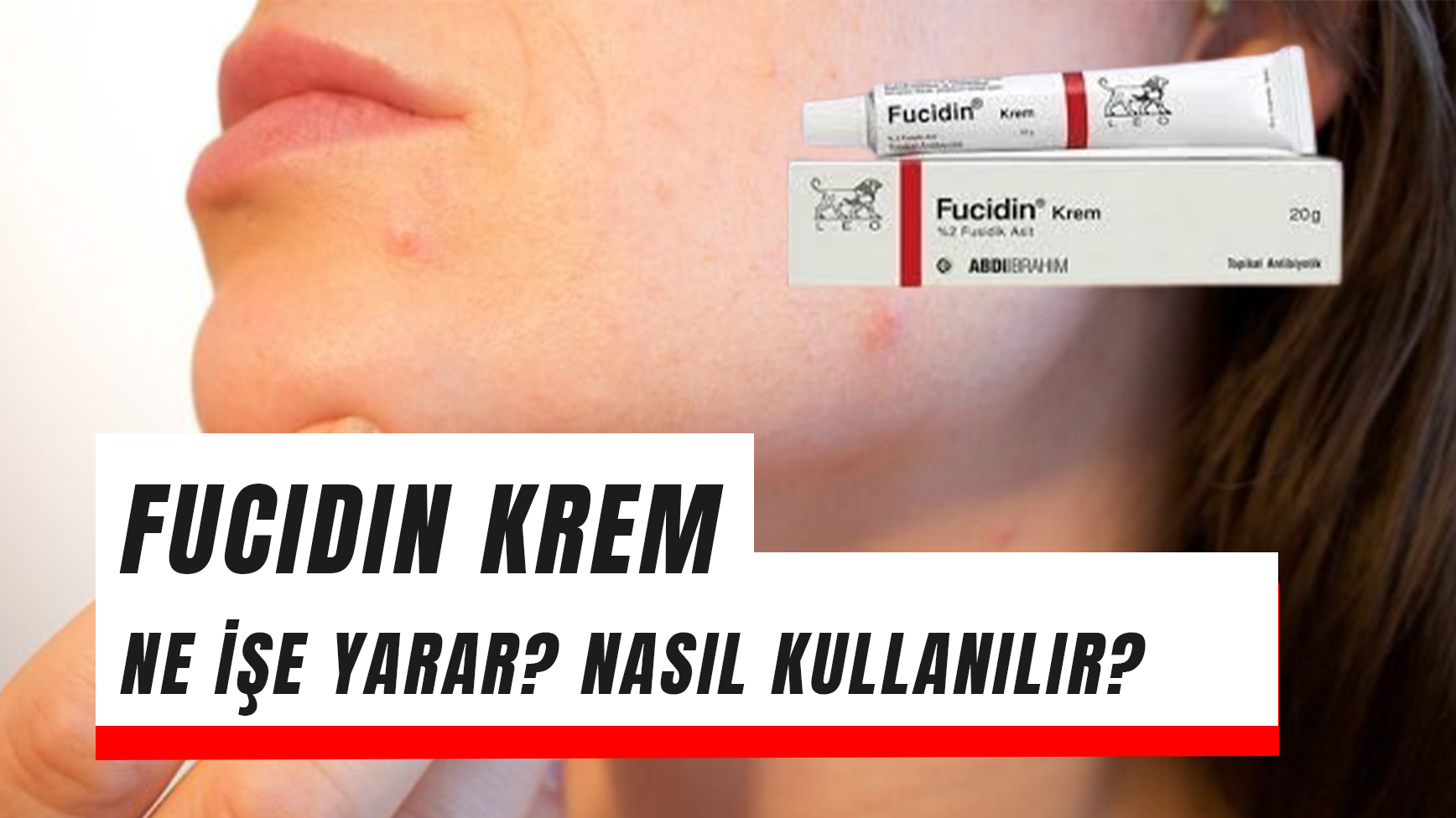 Fucidin Krem Ne İşe Yarar? Nasıl Kullanılır? Yüze Sürülür Mü?